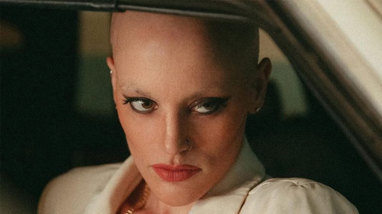 Cat Janice: Πέθανε η 31χρονη Αμερικανίδα τραγουδίστρια που έπασχε από ...